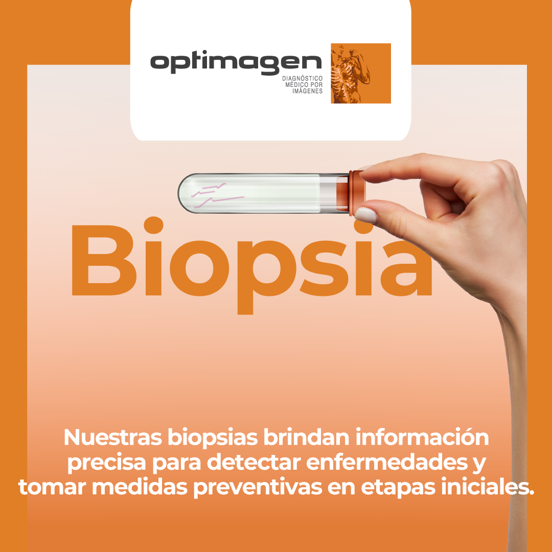 Diagnóstico Preciso Biopsias en OPTIMAGEN - Optimagen