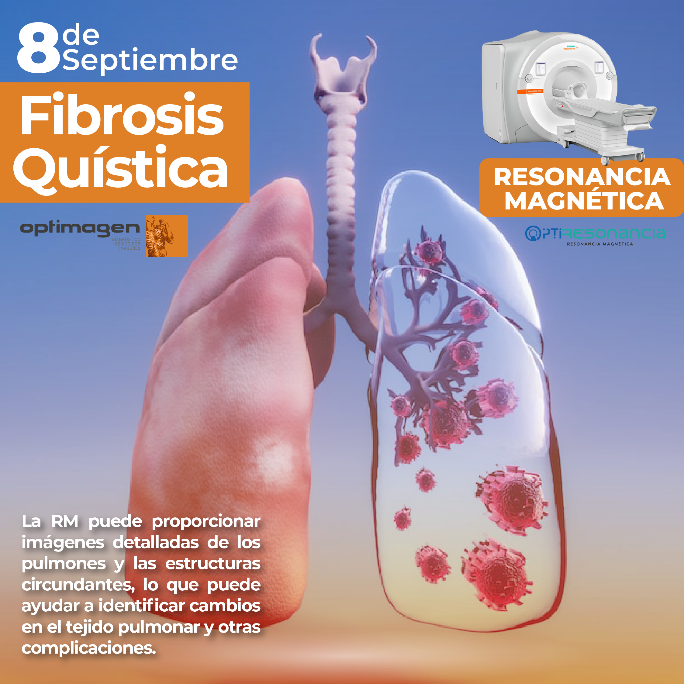 Fibrosis quística Diagnostico Preciso Imagenología Tumbaco