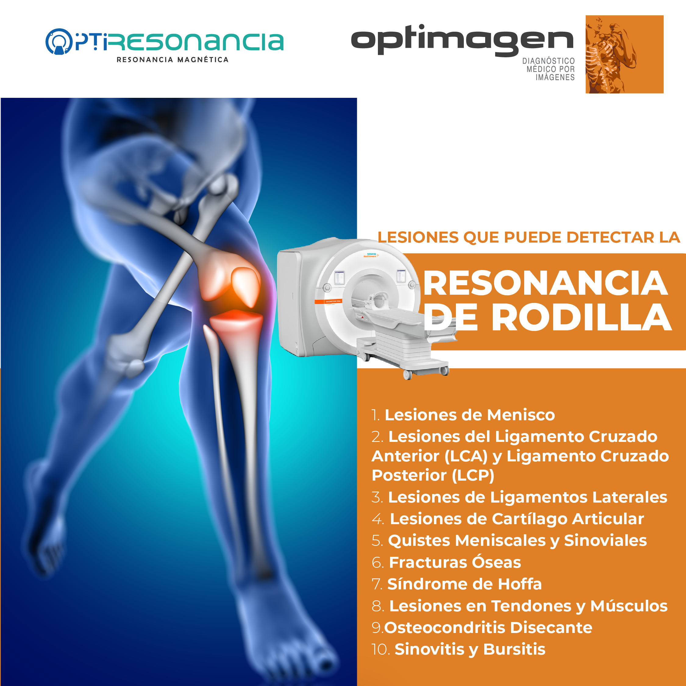 Resonancia magnética de Rodillas Quito