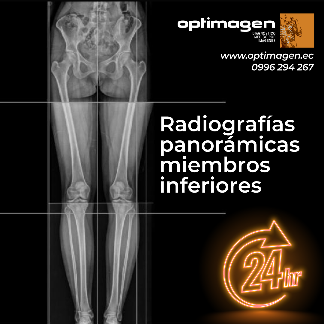 Radiografías Panorámicas de Columna y de Miembros Inferiores